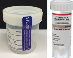 M Health Fairview Laboratory Test Directory | Tests