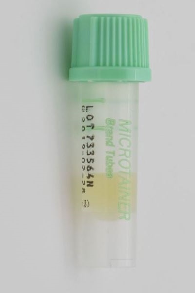 Children's Hospital of Philadelphia Test Directory | Tests