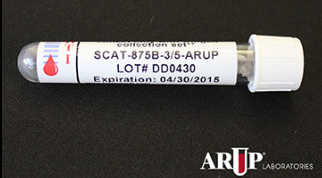 Deaconess Regional Laboratory Test Directory | Tests