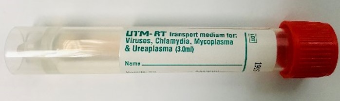 Deaconess Regional Laboratory Test Directory | Tests