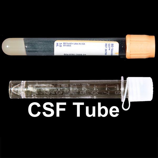Iu Health Lab Test Directory Tests