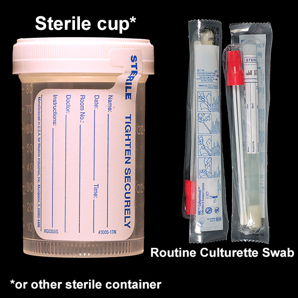 IU Health Lab Test Directory | Tests