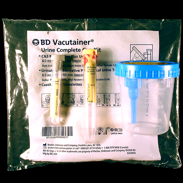Iu Health Lab Test Directory Tests